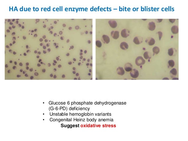 Blog Archives - Run.