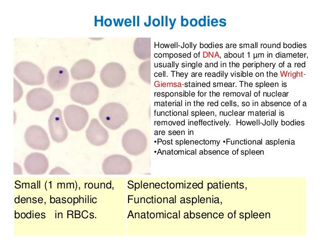 05 peripheral blood smear examination