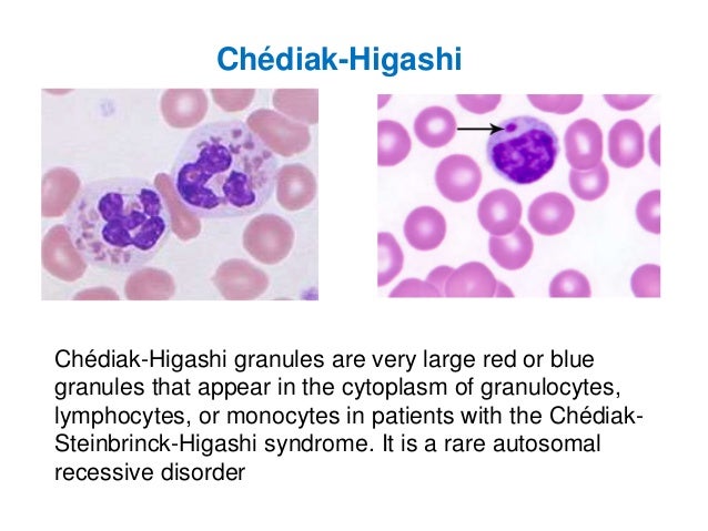 05 peripheral blood smear examination