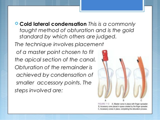 Root canal filling instruments and materials