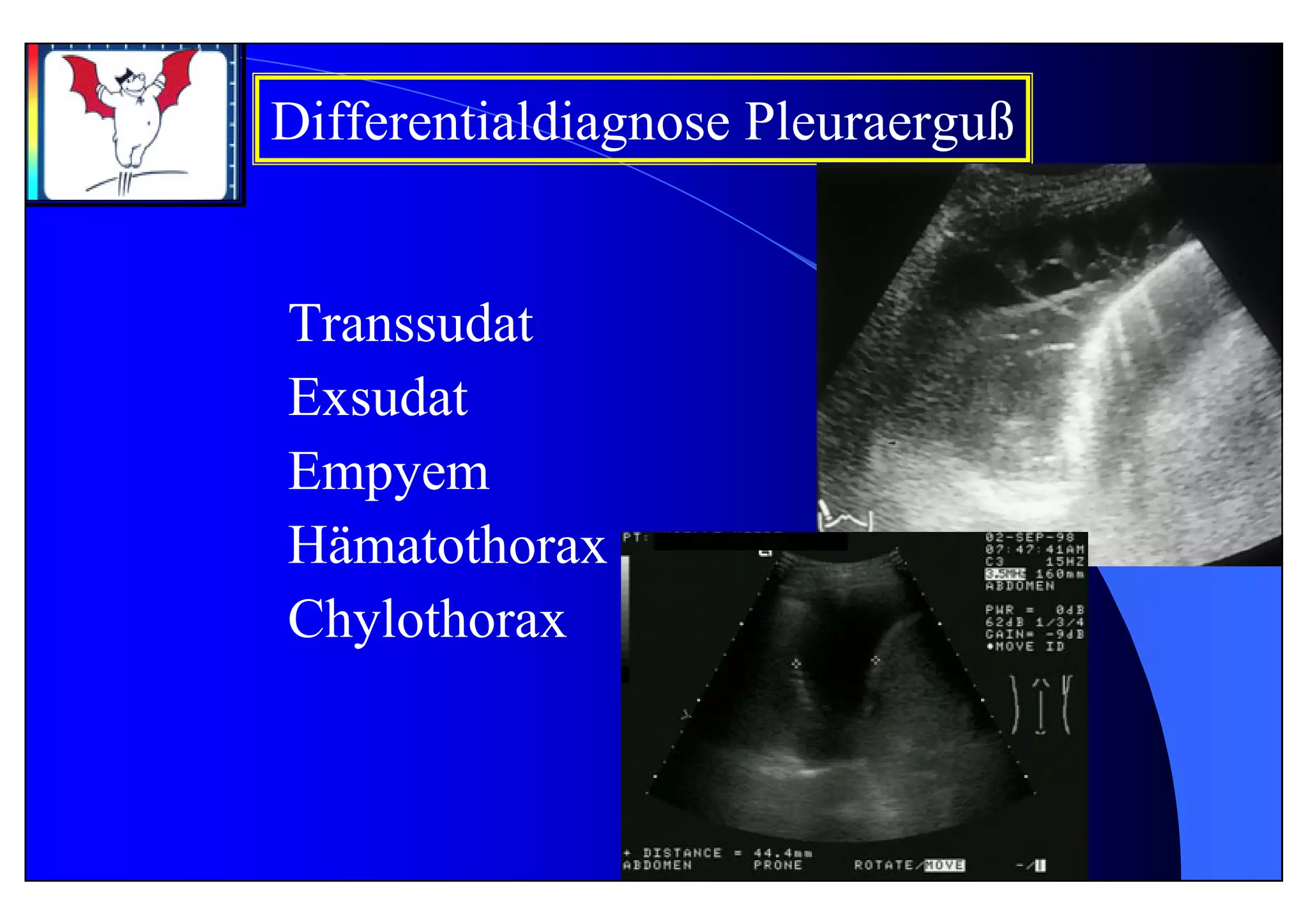 05 Sonographie des Thorax | PDF