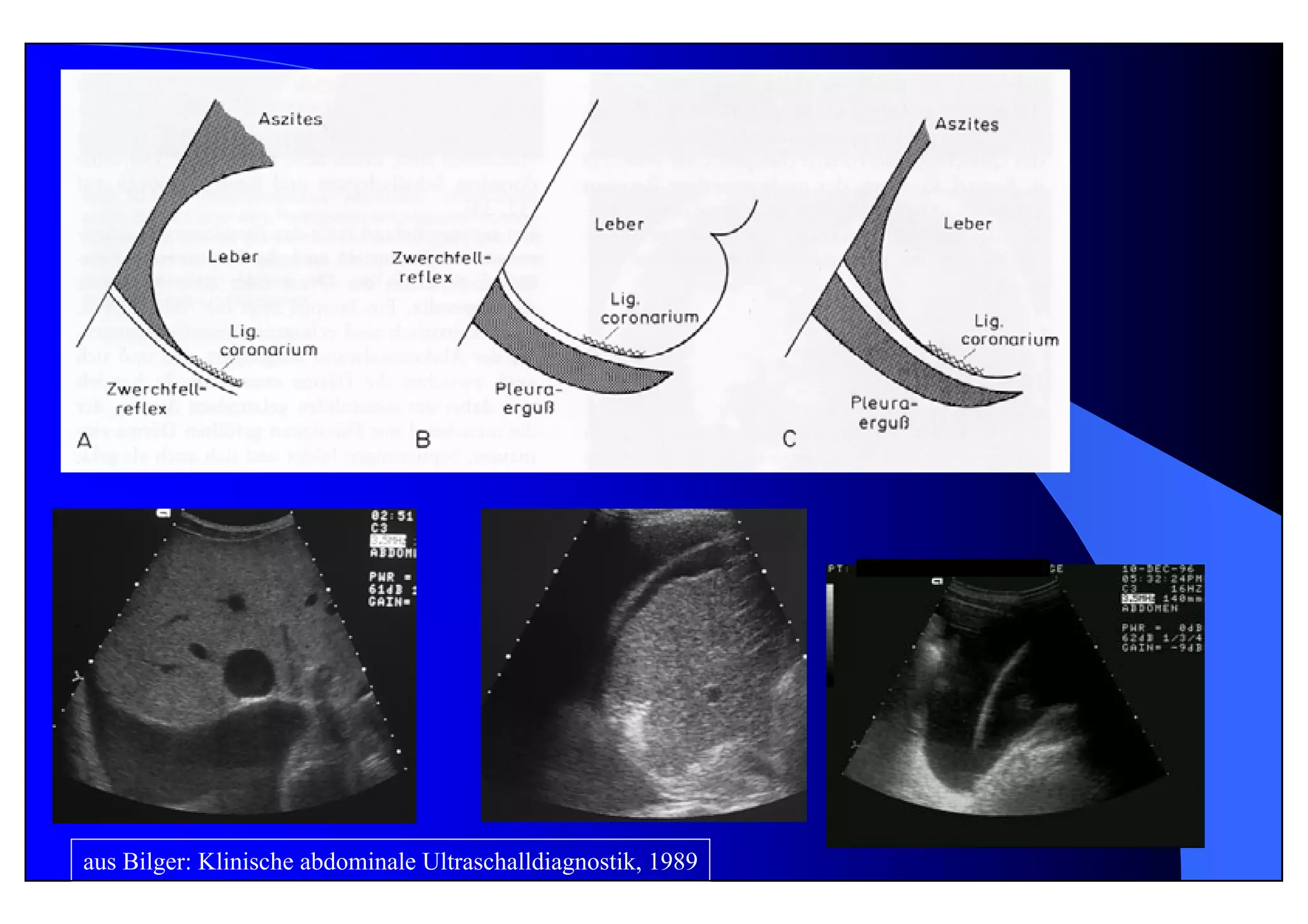 05 Sonographie des Thorax | PDF