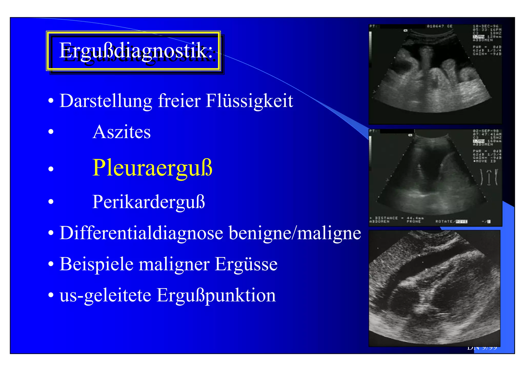 Thorax-Sonographie – Thoraxsonographie Pneumothorax – SJSF