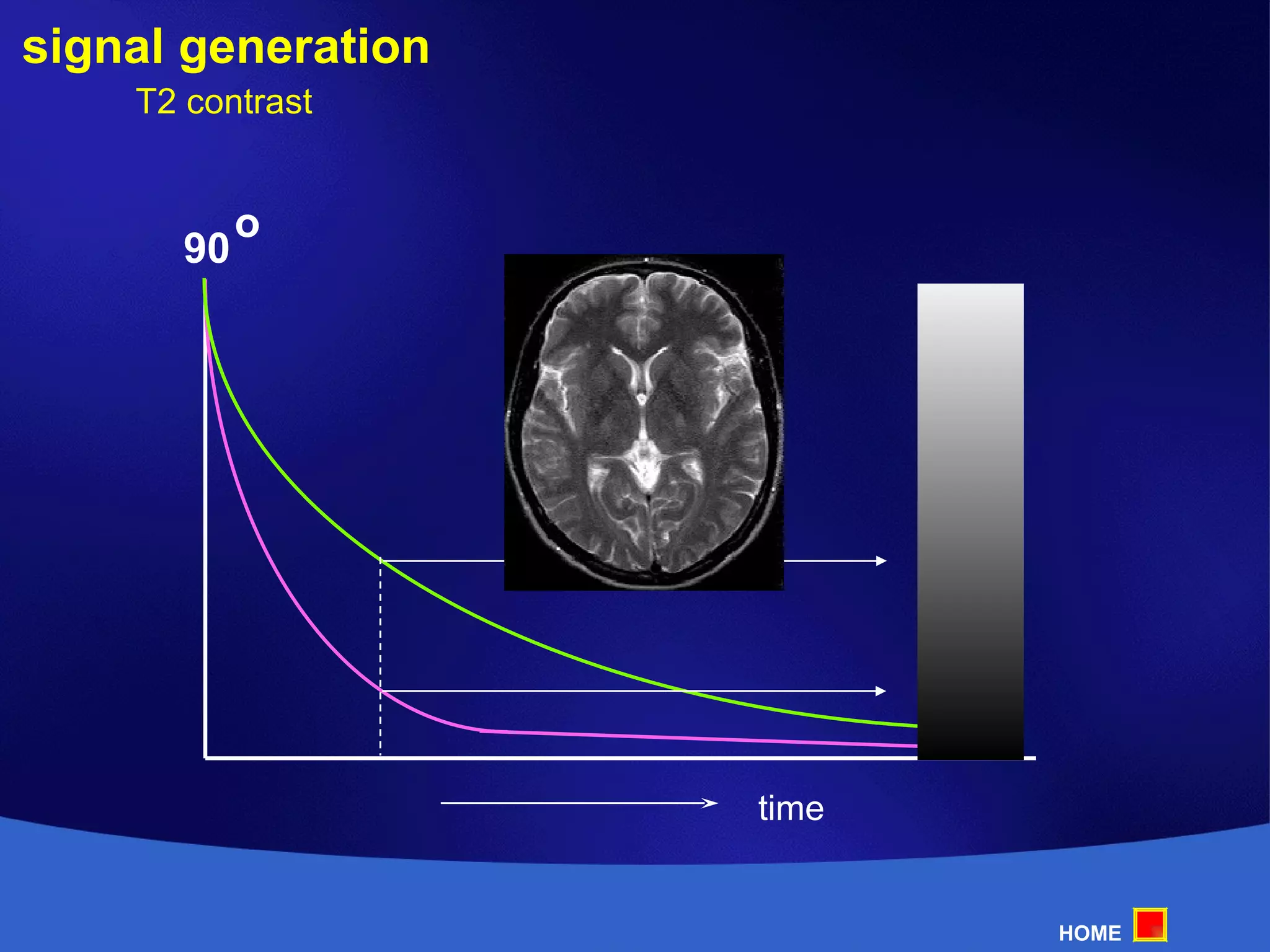 05 t1 y t2 contrast | PPS