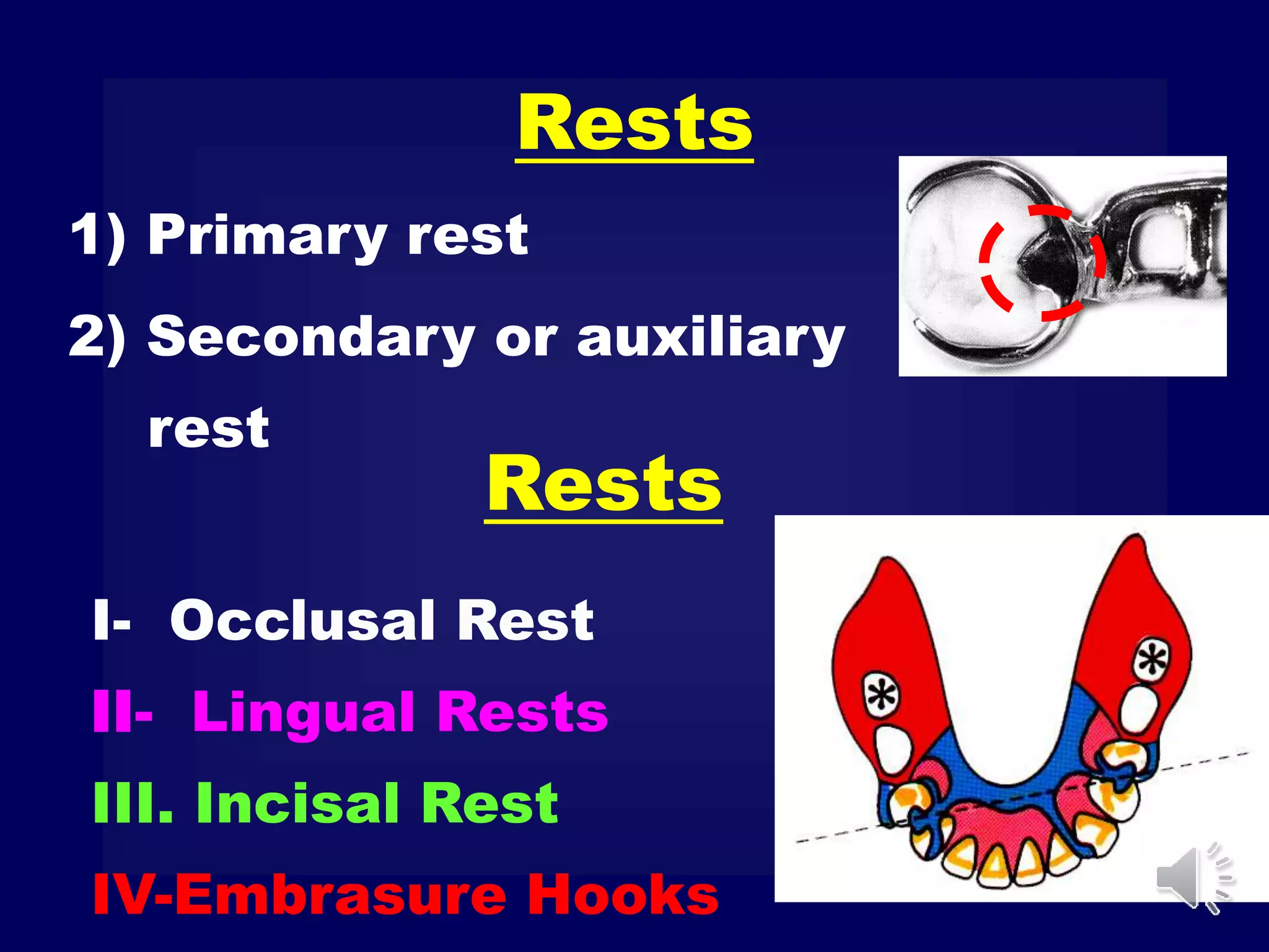 Types of tooth rests 1 | PPT | Dental Health | Diseases and Conditions