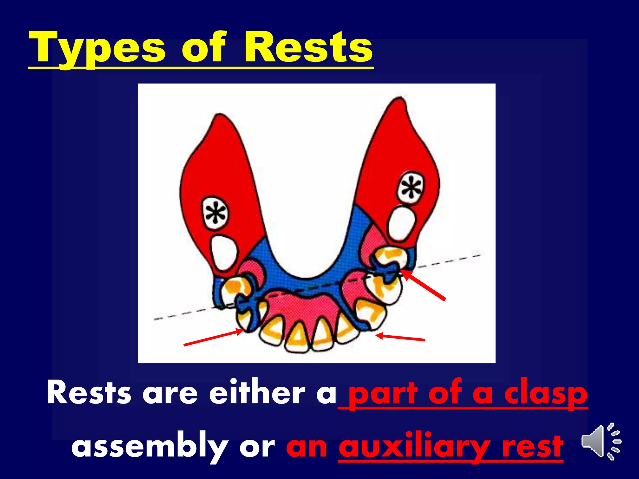 Types of tooth rests 1 | PPT | Dental Health | Diseases and Conditions