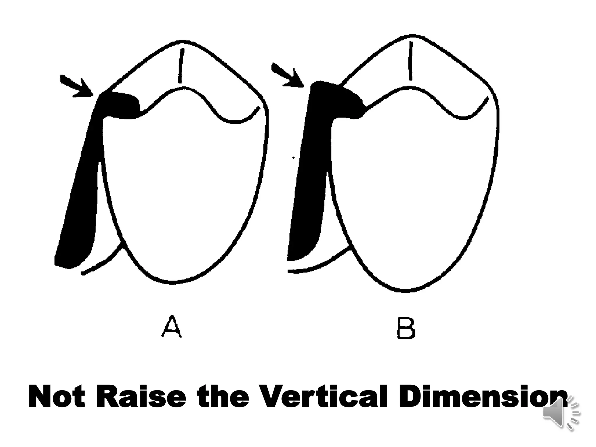 Types of tooth rests 1 | PPT | Dental Health | Diseases and Conditions