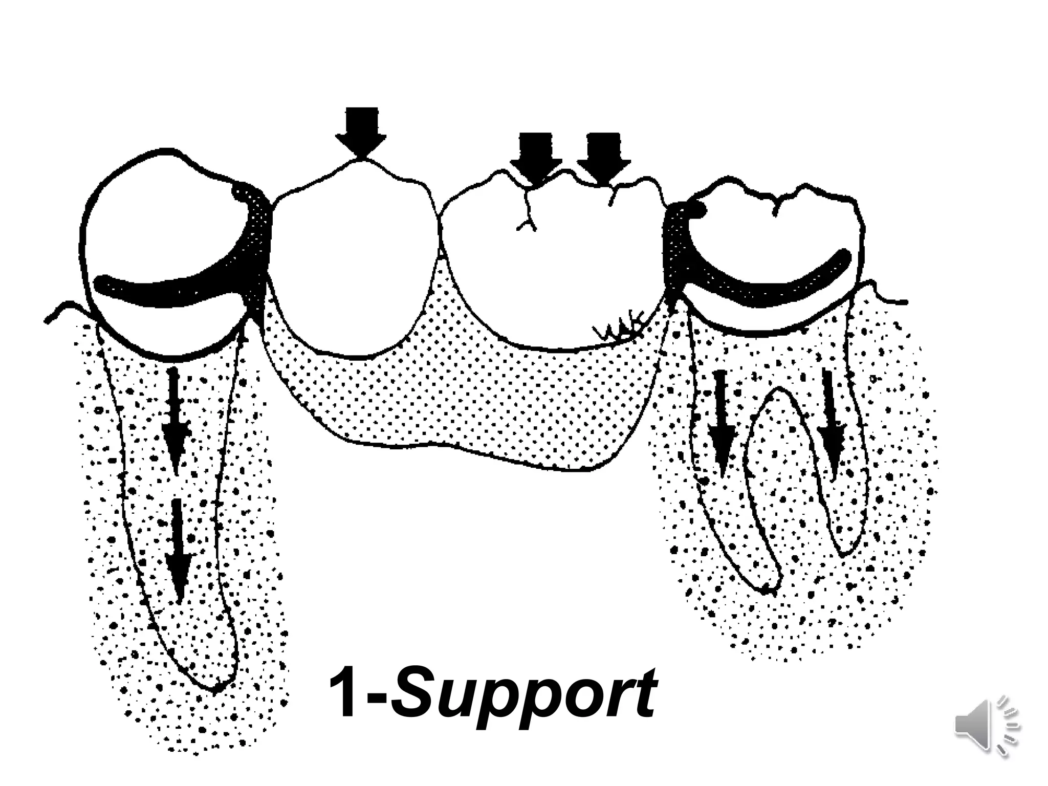 Types of tooth rests 1 | PPT | Dental Health | Diseases and Conditions