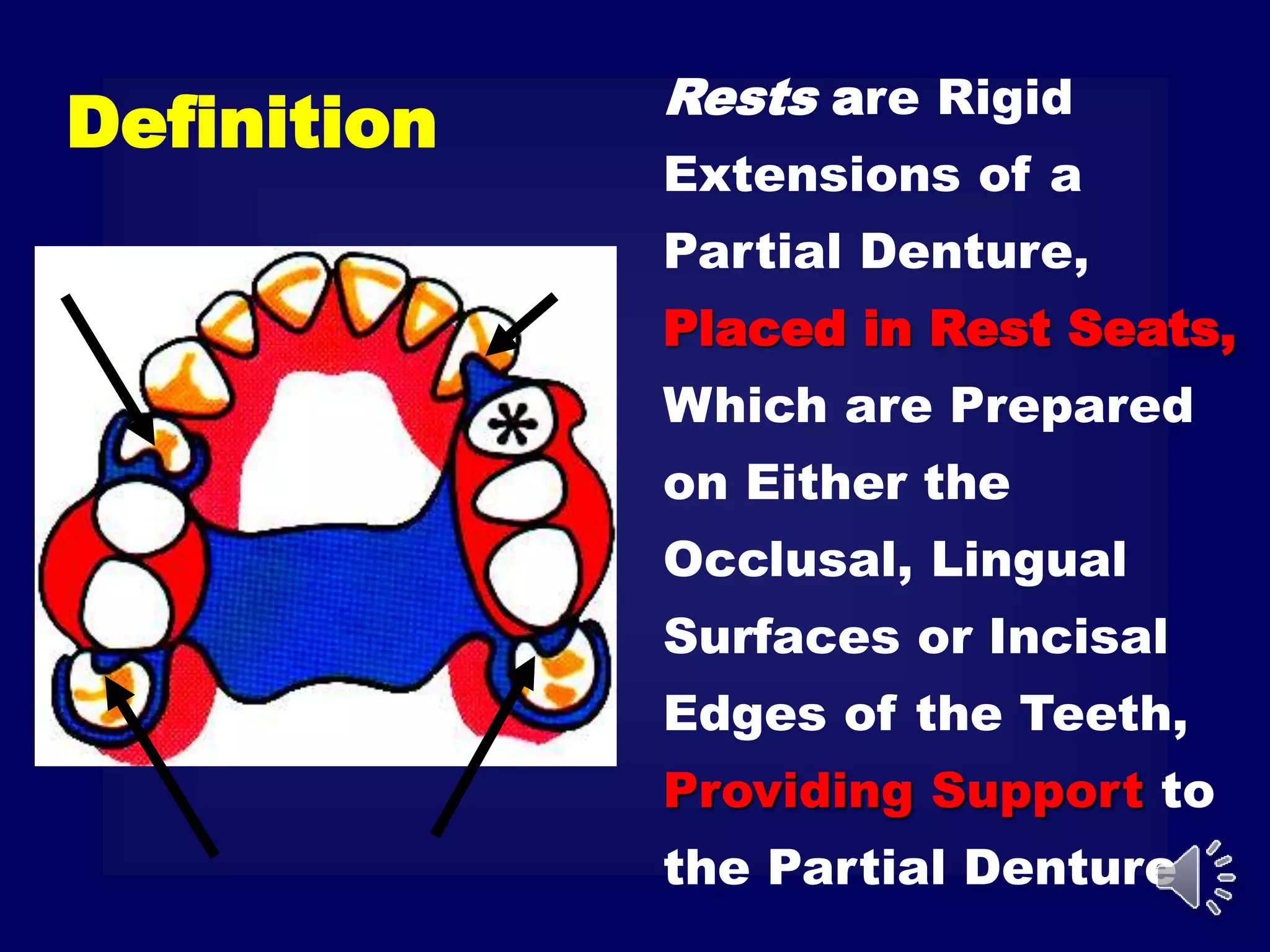 Types of tooth rests 1 | PPT | Dental Health | Diseases and Conditions
