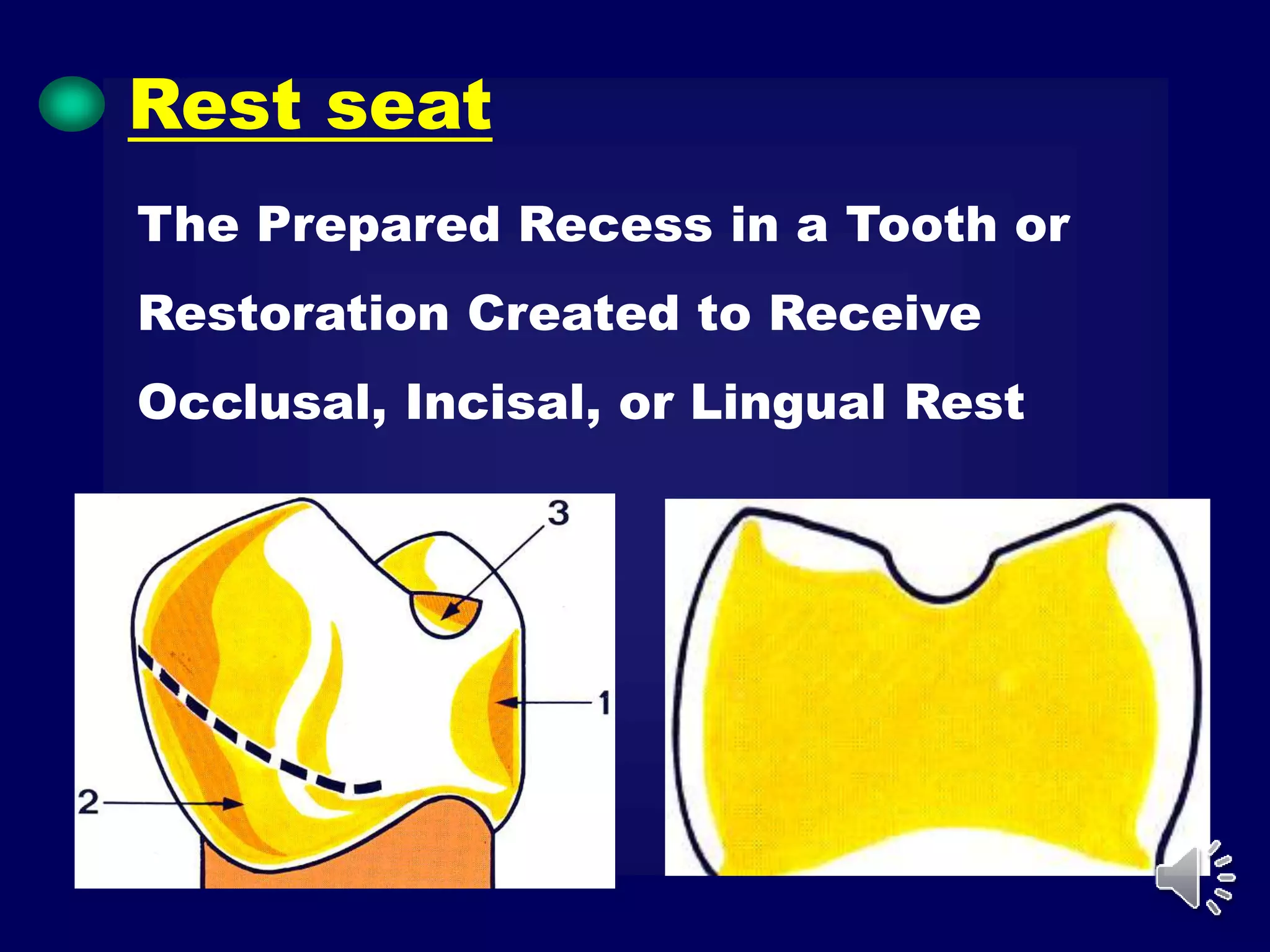 Types of tooth rests 1 | PPT | Dental Health | Diseases and Conditions