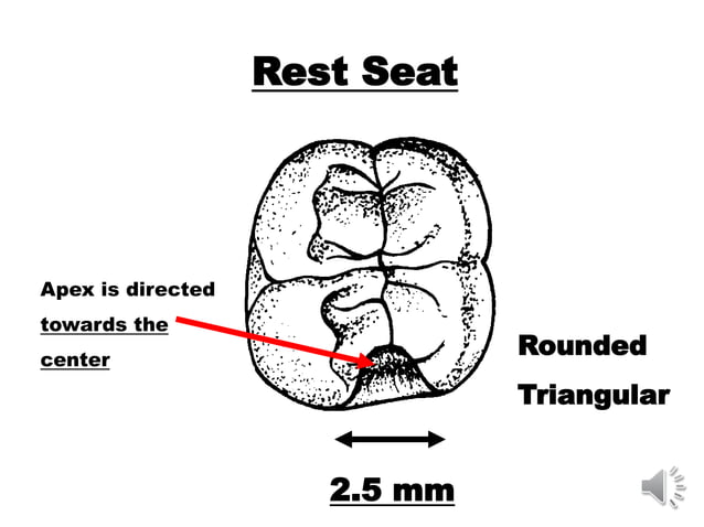 Types of tooth rests 1 | PPT | Dental Health | Diseases and Conditions