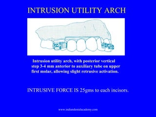 05 utility arch | PPT | Dental Health | Diseases and Conditions