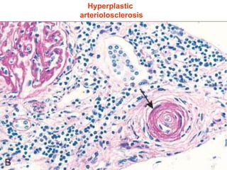 05 vascular pathology | PPT