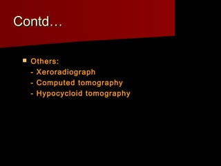06.introduction to middle third fractures | PPT