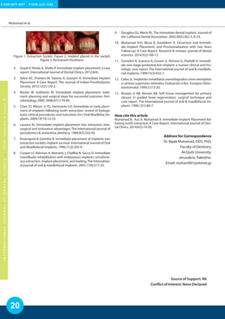 Immediate implant placement following tooth extraction a case report | PDF