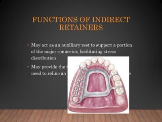 06. indirect retainers and biomechanics | PPT