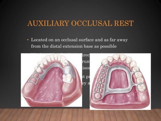 06. indirect retainers and biomechanics | PPTX | Dental Health ...