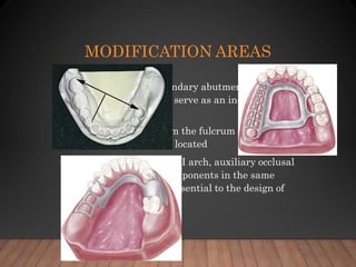06. indirect retainers and biomechanics | PPTX | Dental Health ...
