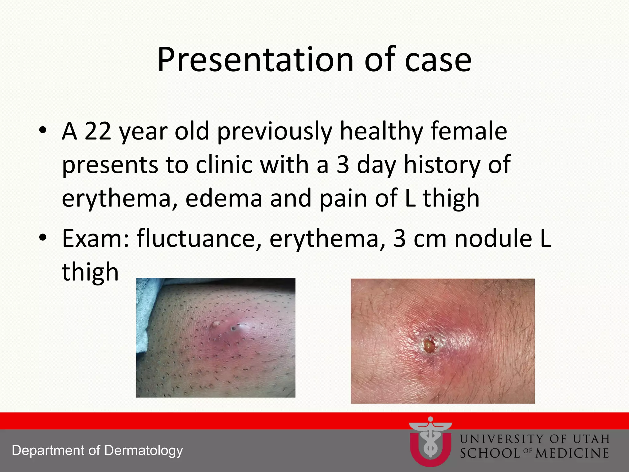 06. Dermatology Pearls and News Flash (Power Point Presentation) Autor ...