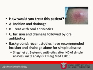 06. Dermatology Pearls and News Flash (Power Point Presentation) Autor ...