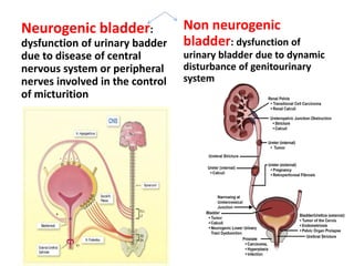 06.05.21-neurogenic-bladder-and-Copy.pdf
