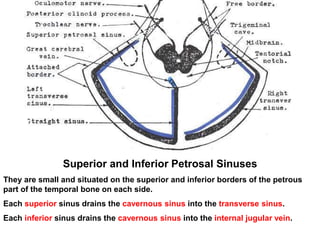 06. venous sinuses.ppt treatment an repair | PPT