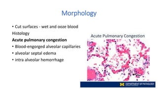 Edema, congestion, Hyperemia and Hemorrhage | PDF