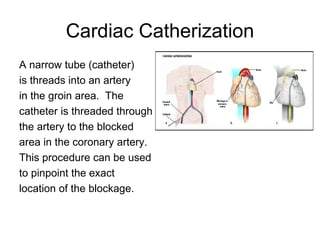 06 circulatory disorders | PPT