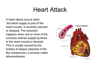 06 circulatory disorders | PPT