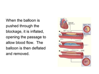 06 circulatory disorders | PPT