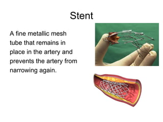 06 circulatory disorders | PPT