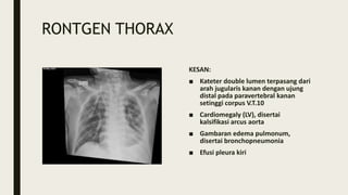 06-dr. Nadia- Kasus Respi.pptx