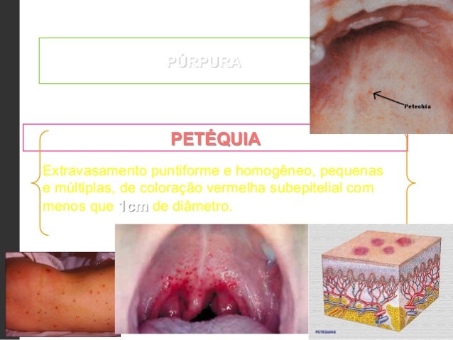 06 lesões fundamentais - parte 1
