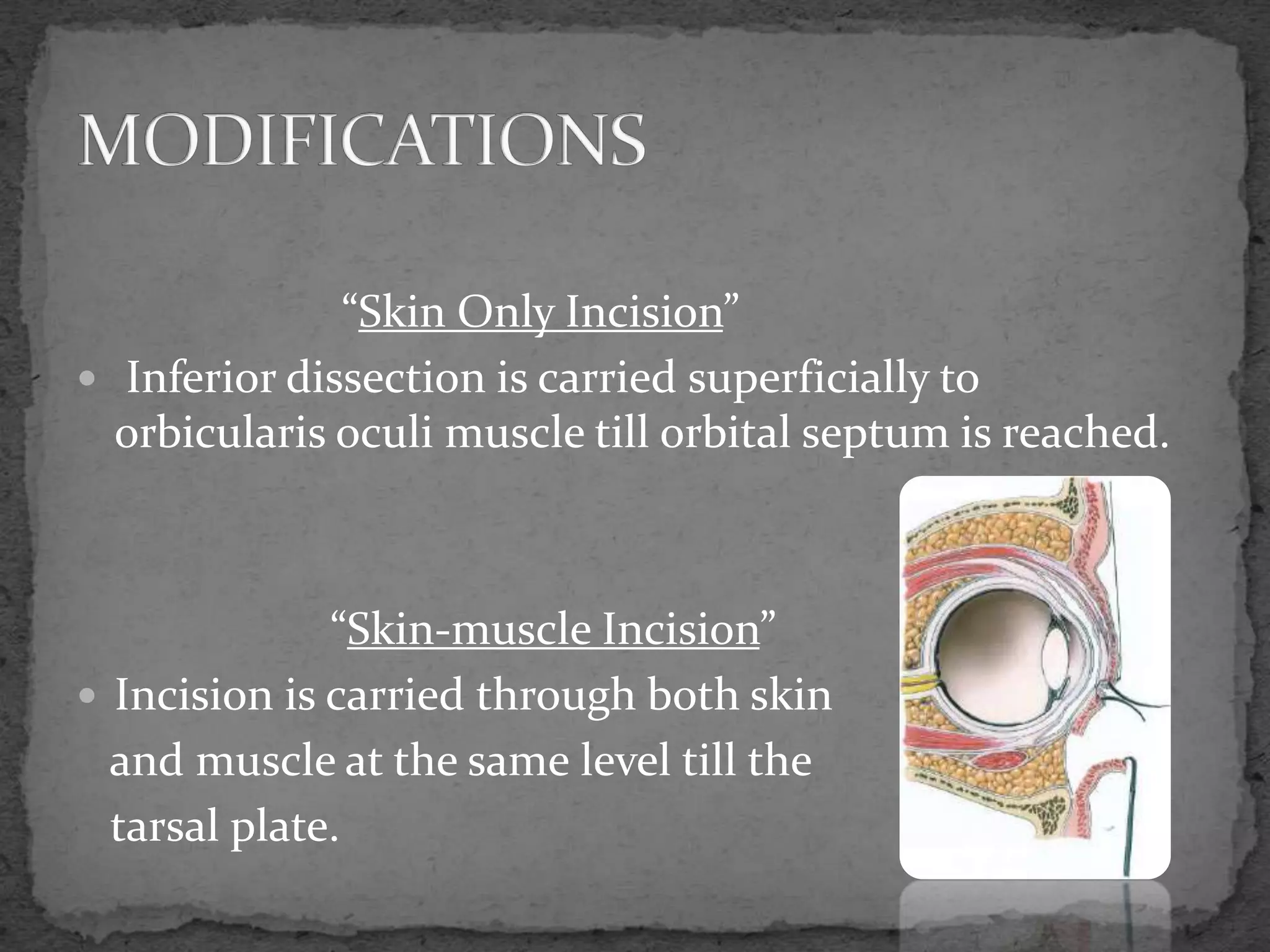 surgical approaches to the orbit | PPTX