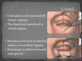 surgical approaches to the orbit | PPT
