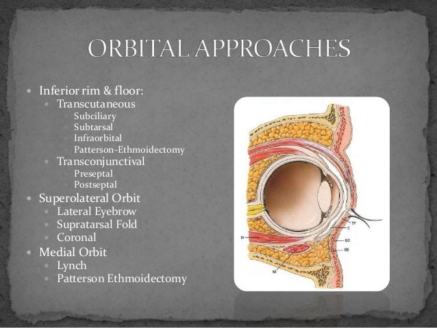 surgical approaches to the orbit surgical approaches to the orbit
