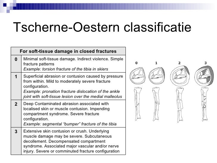 Fractuur classificatie
