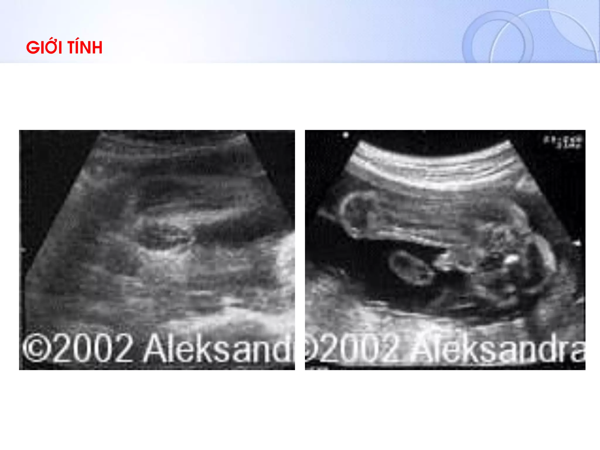 06052013 cac duongcatcobantrongsankhoa_drnguyen | PPT