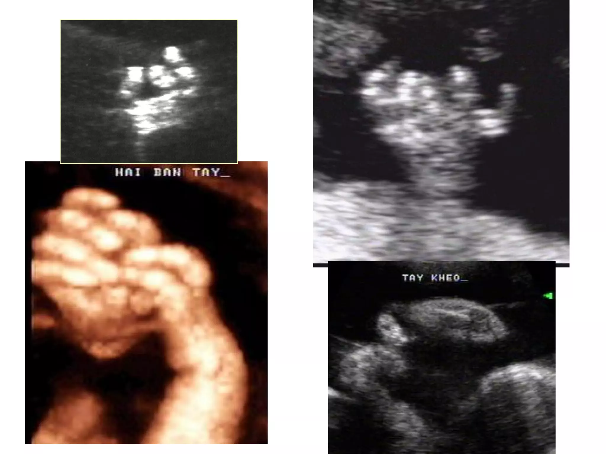 06052013 cac duongcatcobantrongsankhoa_drnguyen | PPT