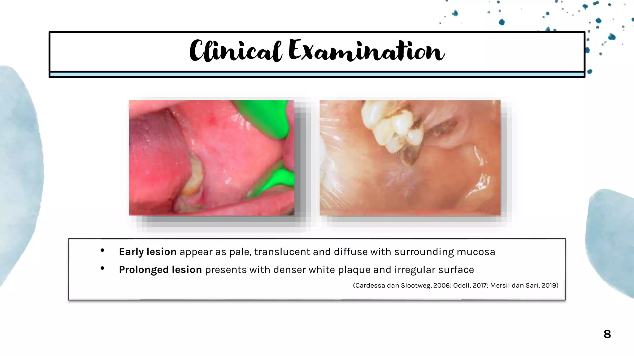 [061021] Frictional Keratosis.pptx