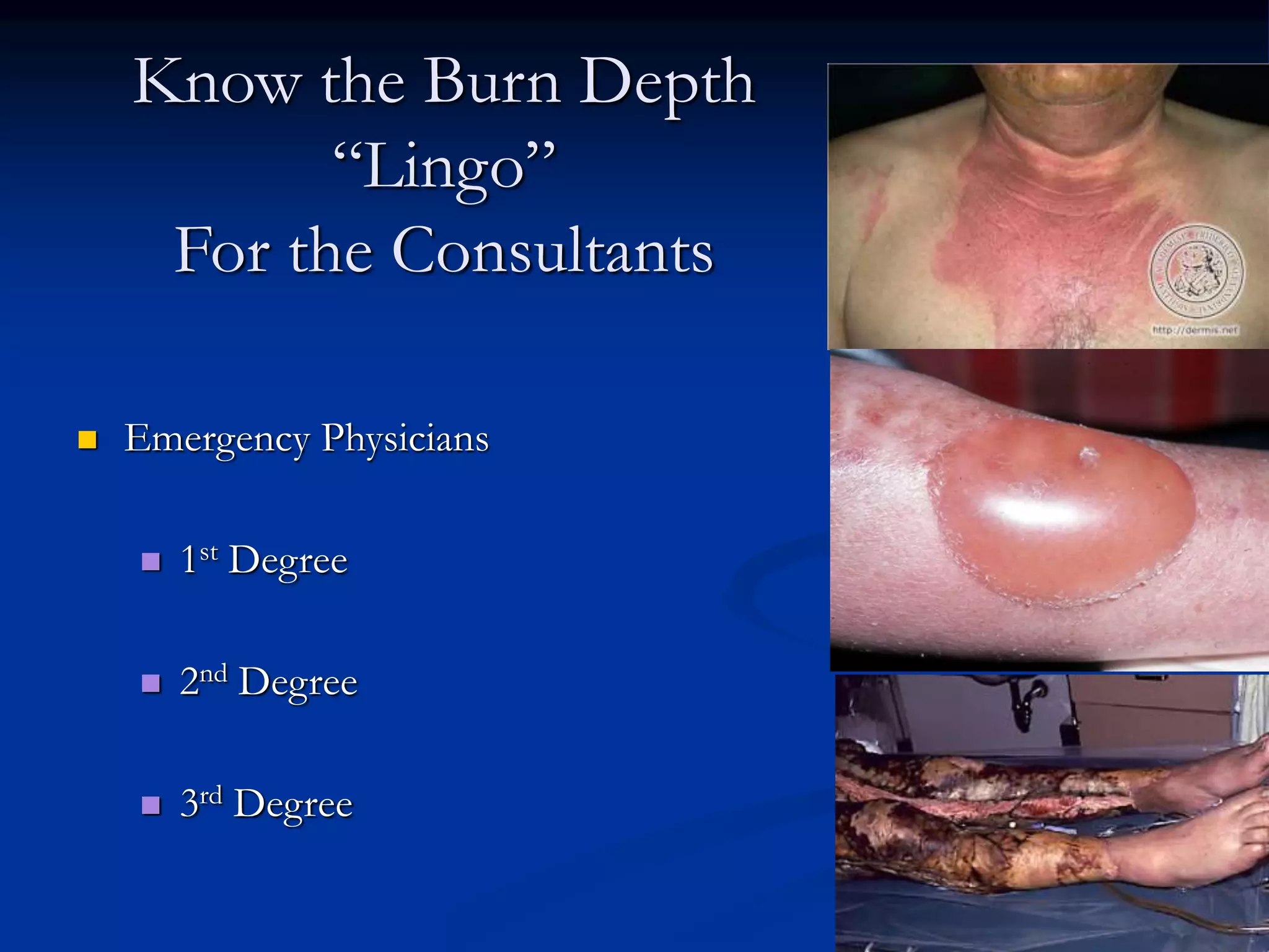 0611151614_critical care burn lecture_Butler_11-14-06_Cond.ppt