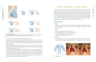 "Asian Rhinoplasty" by Dr. Man Koon Suh "Ch.06 Asian Tip Plasty" | PDF