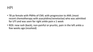Leukemic arthritis - Presentation and XRAY finding | PPTX
