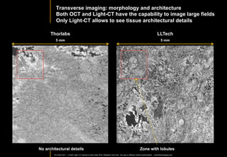 LLTech Light-CT comparison vs OCT and confocal microscopy | PDF