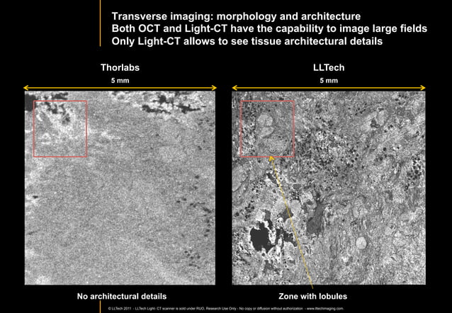 LLTech Light-CT comparison vs OCT and confocal microscopy | PDF