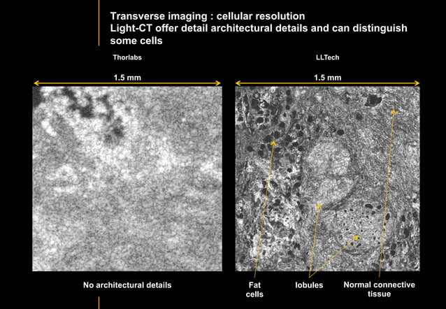 LLTech Light-CT comparison vs OCT and confocal microscopy | PDF