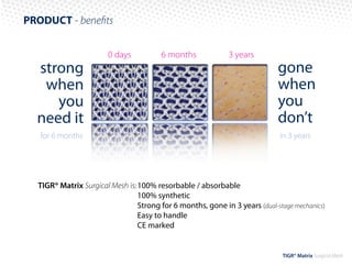 TIGR Matrix Synthetic Long Term Resorbable Surgical mesh | PPT