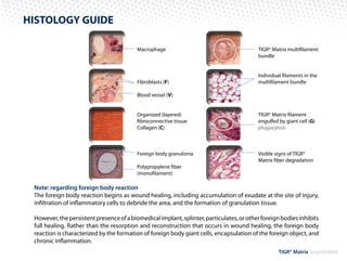 TIGR Matrix Synthetic Long Term Resorbable Surgical mesh | PPT