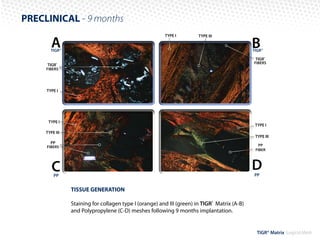 TIGR Matrix Synthetic Long Term Resorbable Surgical mesh | PPT