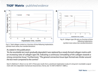 TIGR Matrix Synthetic Long Term Resorbable Surgical mesh | PPT